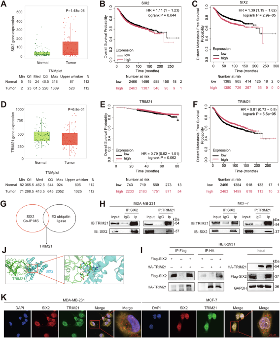 TRIM21-mediated ubiquitination of SIX2 attenuates breast cancer ...
