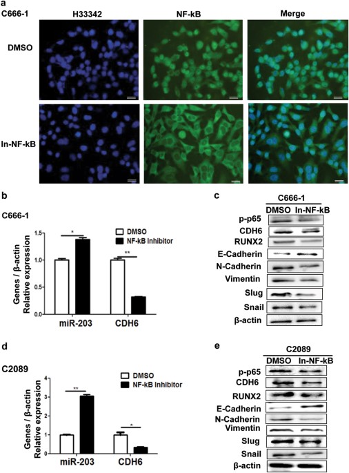 Cadherin 6 is activated by Epstein–Barr virus LMP1 to mediate EMT and ...