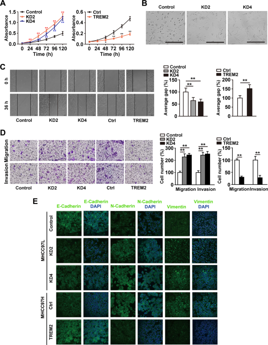 TREM2 acts as a tumor suppressor in hepatocellular carcinoma by ...