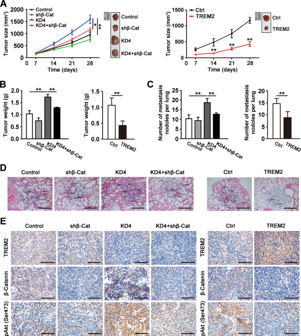 TREM2 acts as a tumor suppressor in hepatocellular carcinoma by ...