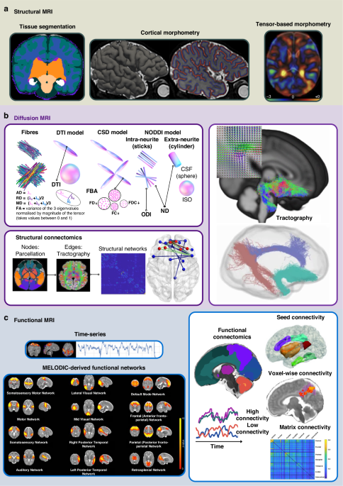Advances in fetal and neonatal neuroimaging and everyday exposures ...