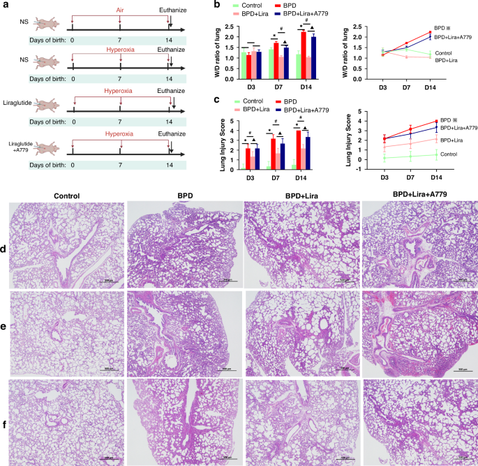 Bronchopulmonary dysplasia induced by hyperoxia attenuated by A GLP-1 ...