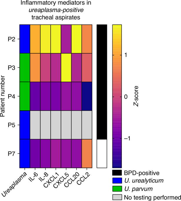 Ureaplasma parvum and Ureaplasma urealyticum induce distinct types of ...