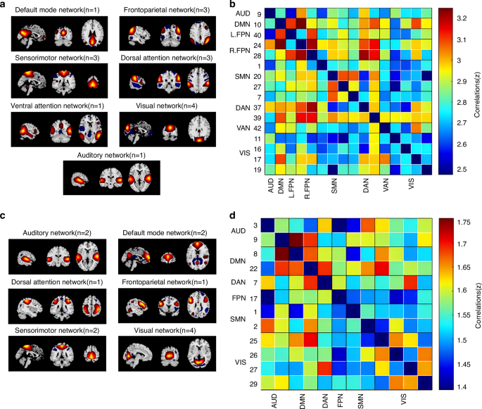 Childhood absence epilepsy and distinct dynamic functional network ...