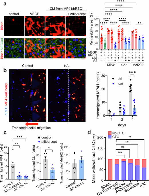 Uveal melanoma with a GNA11/GNAQ mutation secretes VEGF for systemic ...