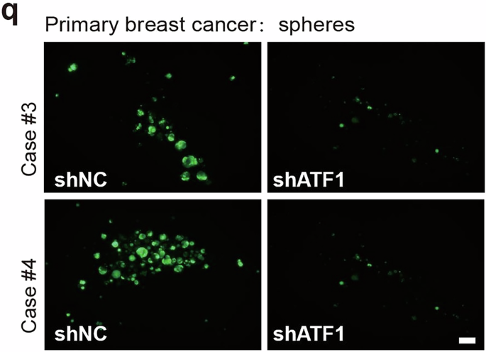 Correction: Cancer cell employs a microenvironmental neural signal ...
