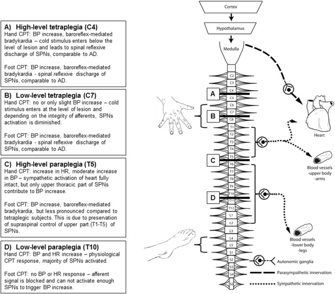 Cold pressor test in spinal cord injury—revisited | Spinal Cord