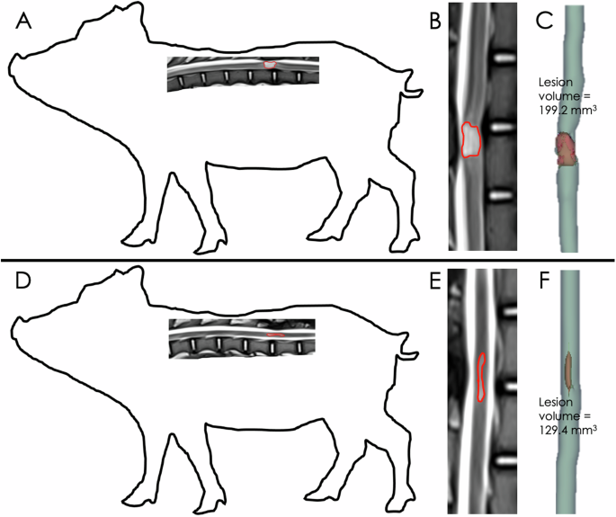 Spinal cord lesion MRI and behavioral outcomes in a miniature pig model ...
