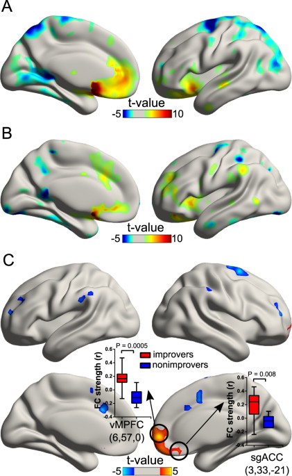 Stimulated left DLPFC-nucleus accumbens functional connectivity ...