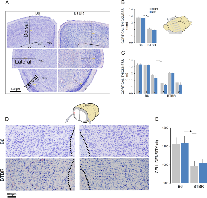 Non-diagnostic symptoms in a mouse model of autism in relation to ...