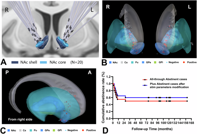 Effects of deep brain stimulation of the nucleus accumbens and anterior ...
