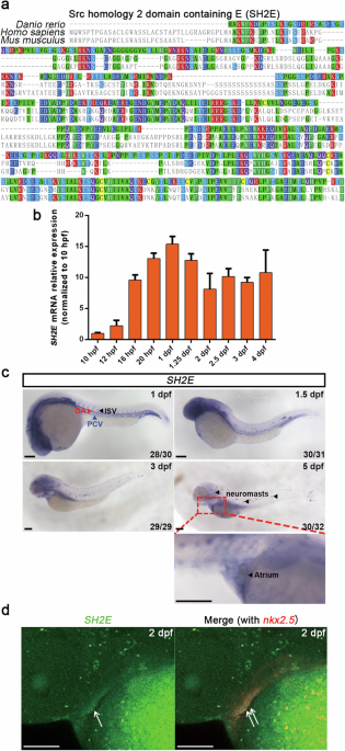 Adaptor protein Src-homology 2 domain containing E (SH2E) deficiency ...