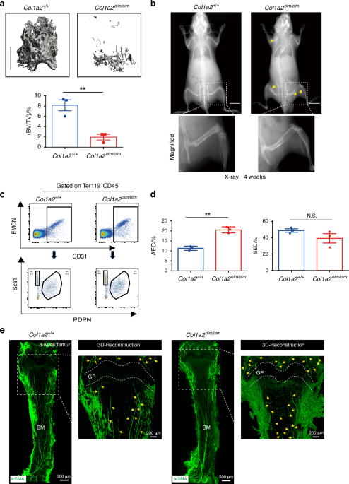 Schnurri-3 inhibition rescues skeletal fragility and vascular skeletal ...