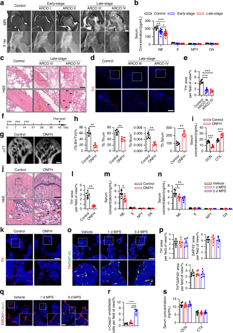 Inhibition of sympathetic tone via hypothalamic descending pathway ...