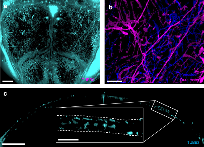 3D imaging reveals changes in the neurovascular architecture of the ...