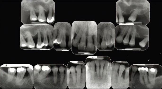 Periodontal diagnosis in the context of the BSP implementation plan for ...