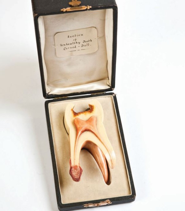 Treasures from the BDA Museum and Library | British Dental Journal