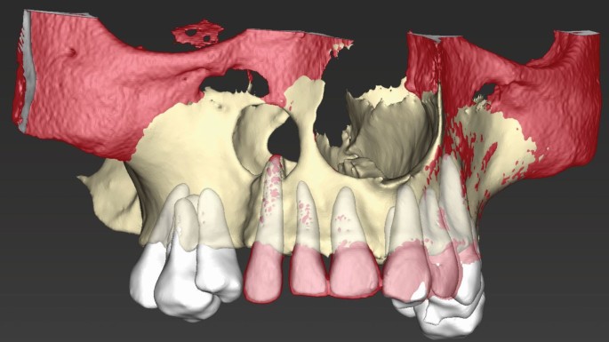 AI in oral surgery: promise and prudence | British Dental Journal