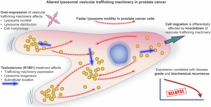 Altered expression of vesicular trafficking machinery in prostate ...
