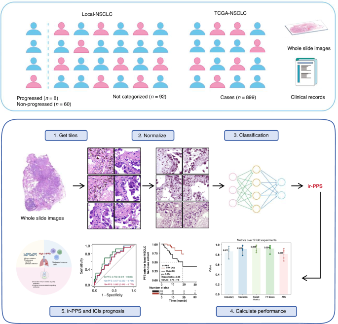 Deep learning analysis of histopathological images predicts immunotherapy prognosis and reveals ...