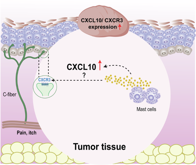 Enhanced CXCL10 expression in mast cells for cutaneous neurofibroma ...
