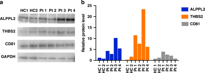 Exosomal ALPPL2 and THBS2 as biomarkers for early detection and disease ...