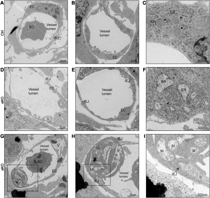Heme accumulation in endothelial cells impairs angiogenesis by ...