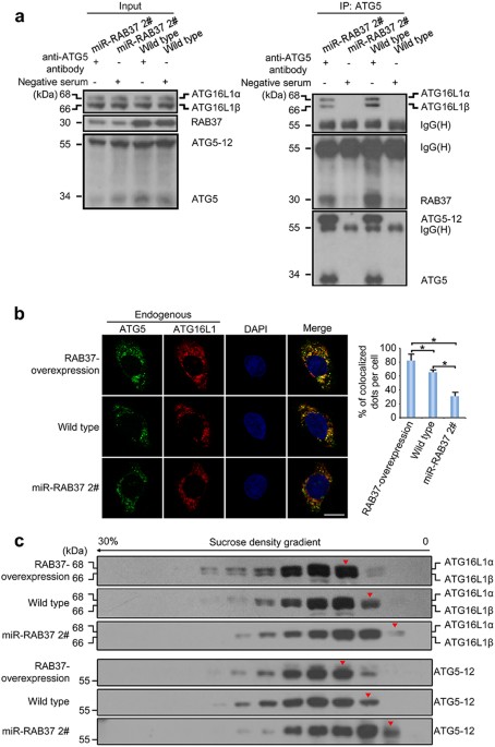 RAB37 interacts directly with ATG5 and promotes autophagosome formation ...