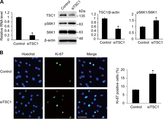 miR-92b-3p-TSC1 axis is critical for mTOR signaling-mediated vascular ...