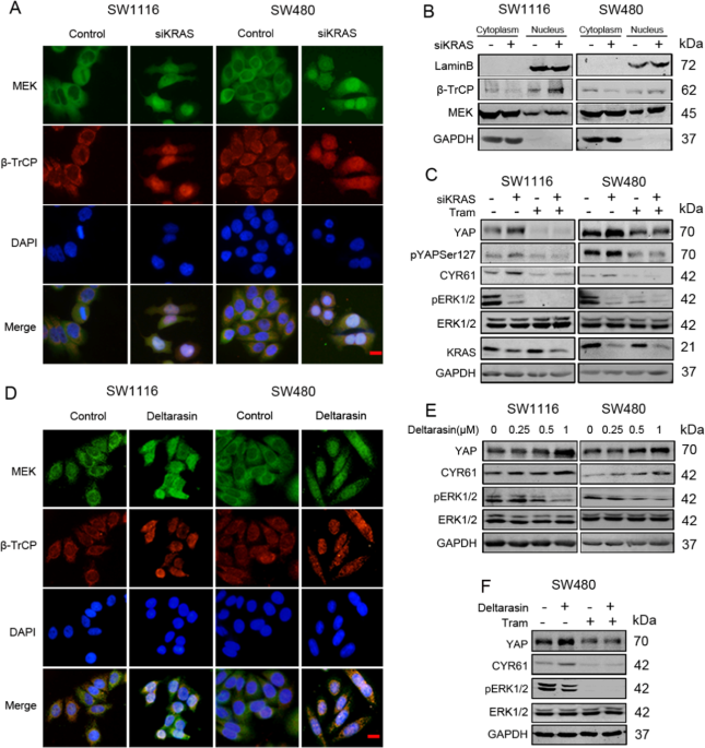 MEK nuclear localization promotes YAP stability via sequestering β-TrCP ...