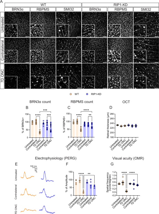 RIP1 inhibition protects retinal ganglion cells in glaucoma models of ...