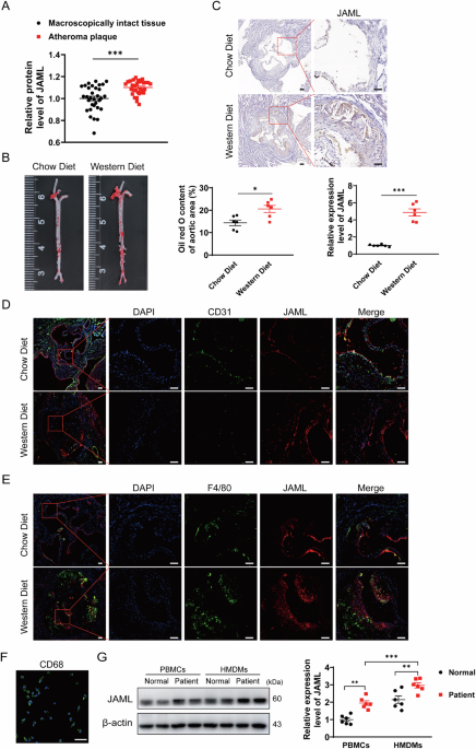Macrophage junctional adhesion molecule-like (JAML) protein promotes ...