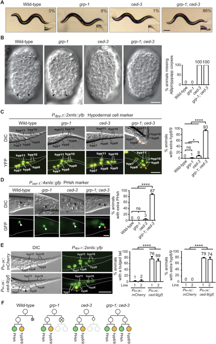 Uridine 5’-monophosphate (UMP) synthesis connects nucleotide metabolism ...
