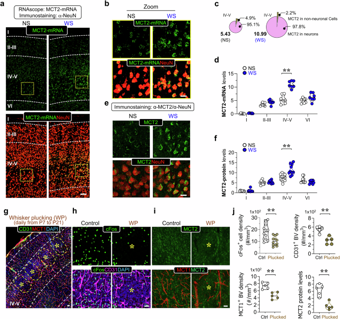 Neuronal MCT2 promotes angiogenesis via lactate in the developing mouse ...