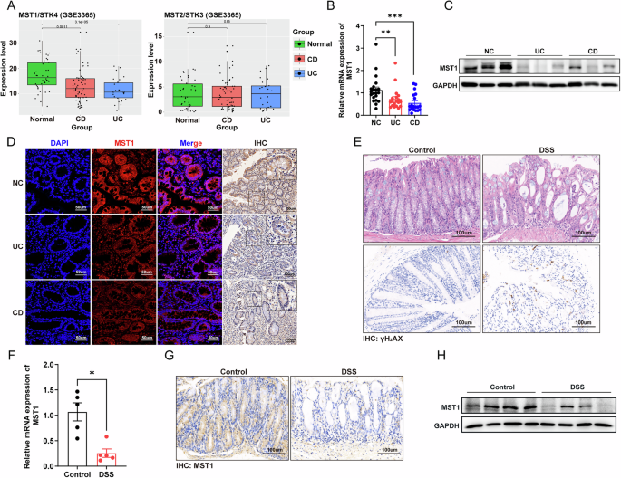 Epithelial MST1 deficiency promotes pyroptosis and aggravates ...
