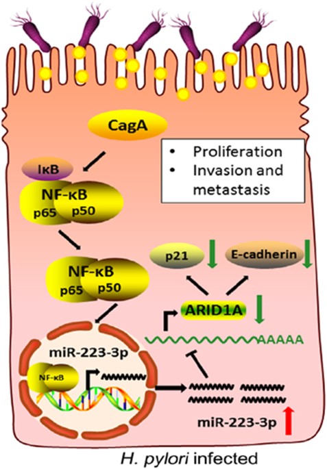 NF-κB/miR-223-3p/ARID1A axis is involved in Helicobacter pylori CagA ...