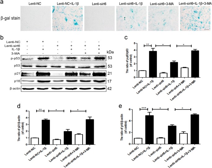 Sirt6 overexpression suppresses senescence and apoptosis of nucleus ...