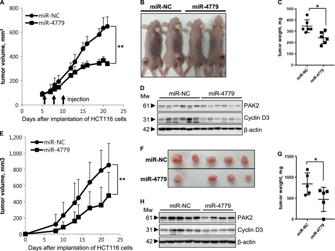 MicroRNA miR-4779 suppresses tumor growth by inducing apoptosis and ...