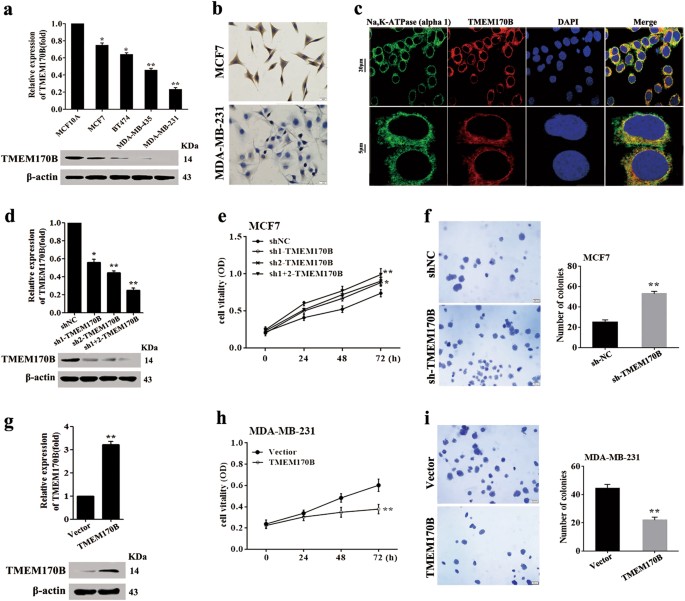 Transmembrane protein 170B is a novel breast tumorigenesis suppressor ...