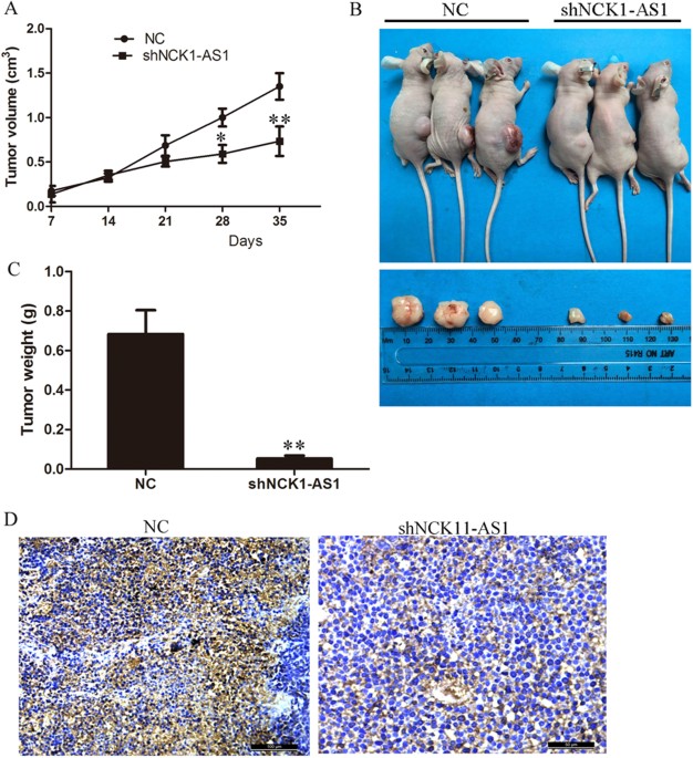 LncRNA NCK1-AS1 promotes proliferation and induces cell cycle ...