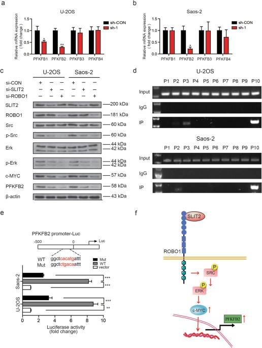 SLIT2/ROBO1 axis contributes to the Warburg effect in osteosarcoma ...