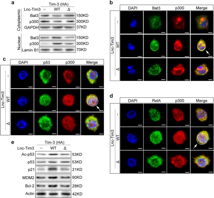Long non-coding RNA Lnc-Tim3 exacerbates CD8 T cell exhaustion via ...