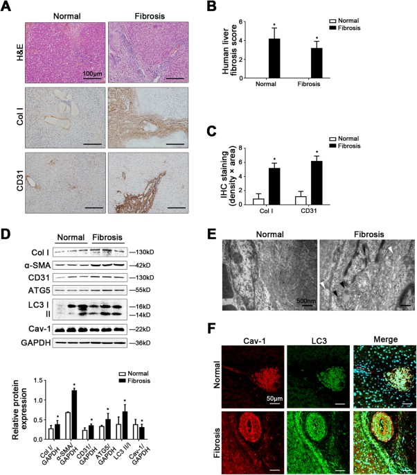 Autophagic degradation of caveolin-1 promotes liver sinusoidal ...