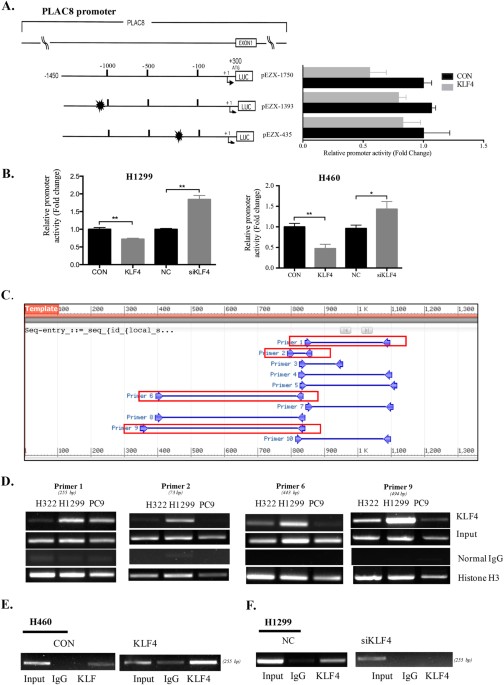 The novel KLF4/PLAC8 signaling pathway regulates lung cancer growth ...
