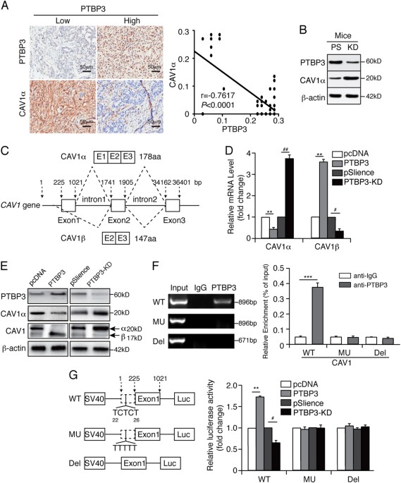 PTBP3 contributes to the metastasis of gastric cancer by mediating CAV1 ...