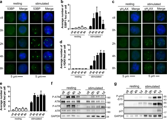 Resting T cells are hypersensitive to DNA damage due to defective DNA ...