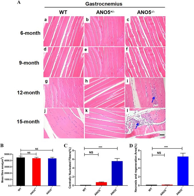 Development of muscular dystrophy in a CRISPR-engineered mutant rabbit ...