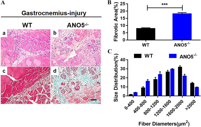 Development of muscular dystrophy in a CRISPR-engineered mutant rabbit ...