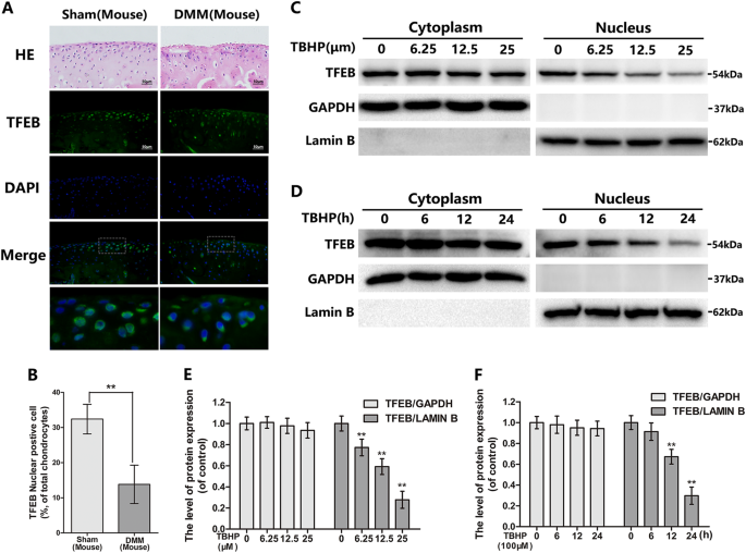 TFEB, a potential therapeutic target for osteoarthritis via autophagy ...