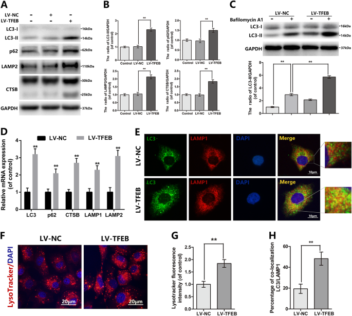 TFEB, a potential therapeutic target for osteoarthritis via autophagy ...